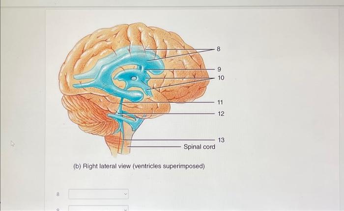 Solved (b) Right lateral view (ventricles superimposed) | Chegg.com