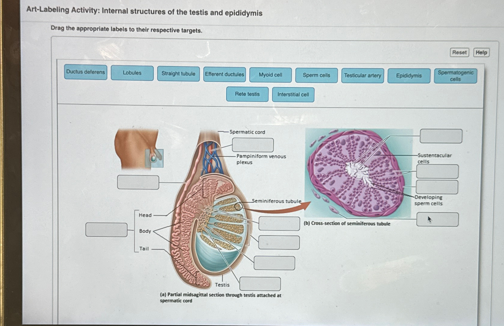 Solved Art-Labeling Activity: Internal structures of the | Chegg.com