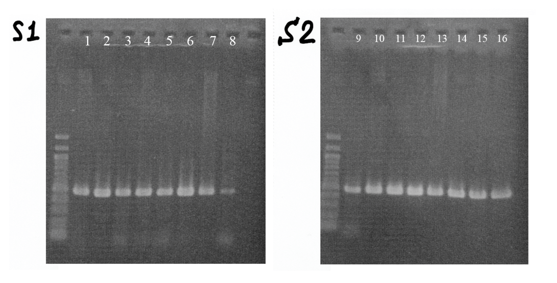 Solved I did a lab where after PCR we performed DNA | Chegg.com