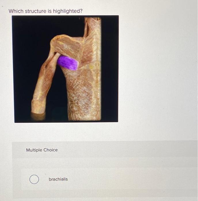 Solved Which structure is highlighted? Multiple Choice | Chegg.com