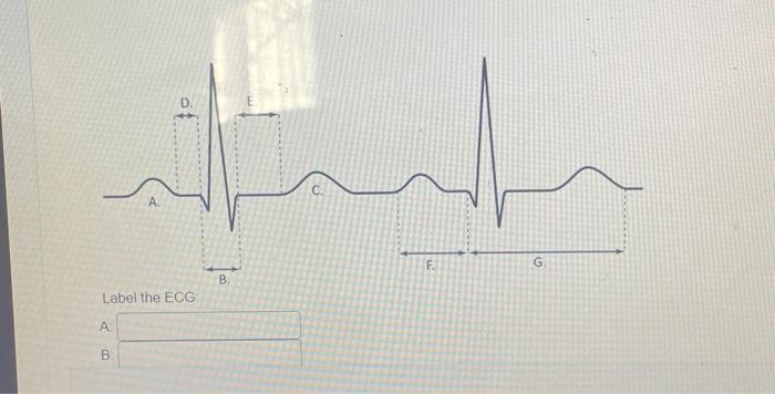 Solved Label the ECG A B | Chegg.com