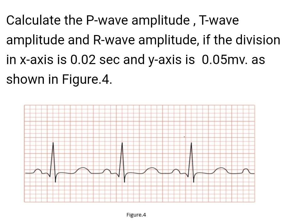 Solved Calculate the P-wave amplitude , T-wave amplitude and | Chegg.com