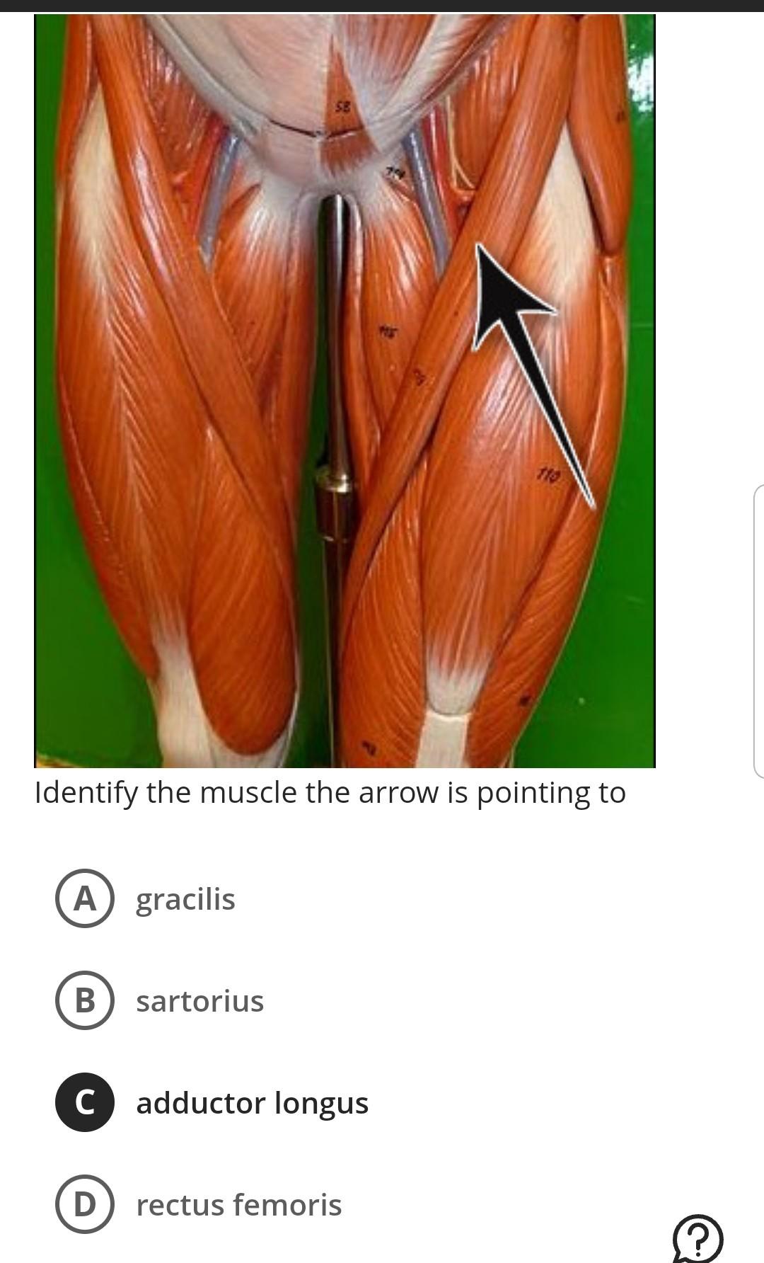 Solved 58 Identify the muscle the arrow is pointing to A) | Chegg.com