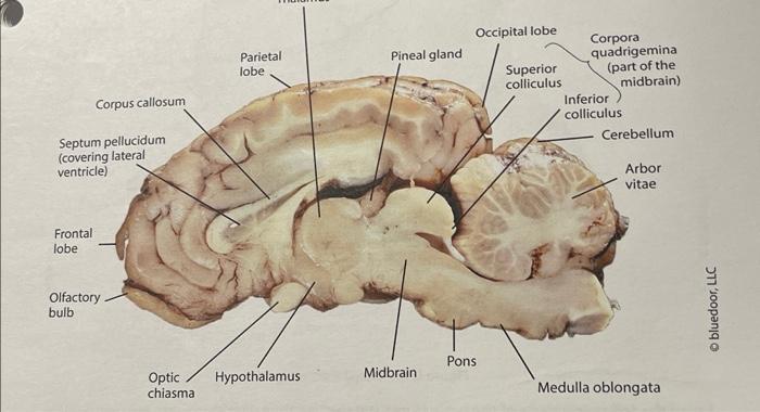 Solved Match the following structures to the sheep brain. | Chegg.com Solved Match the following structures to the sheep brain. | Chegg.com