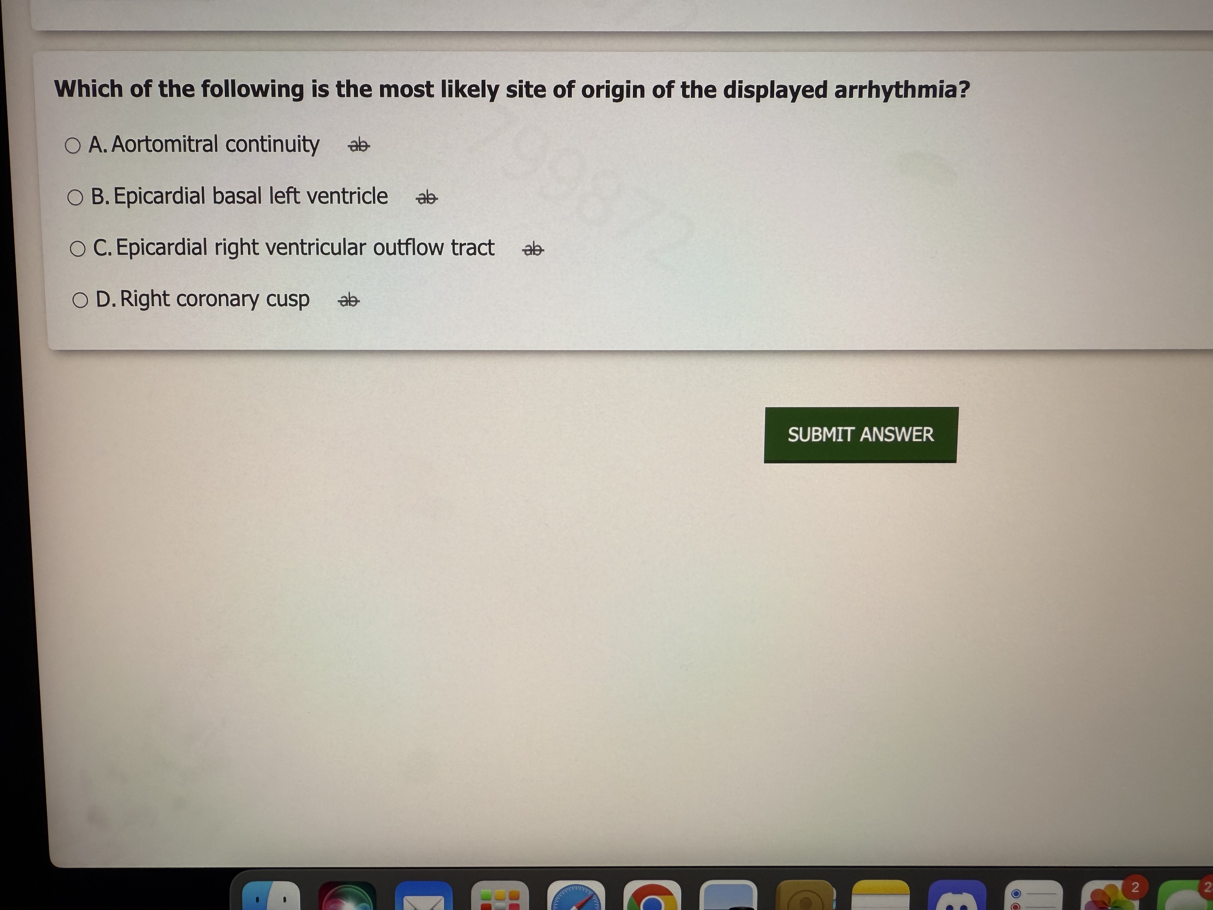 Solved Which of the following is the most likely site of | Chegg.com