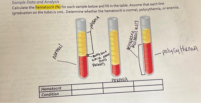Solved Sample Data and Analysis Calculate the hematocrit (%) | Chegg.com