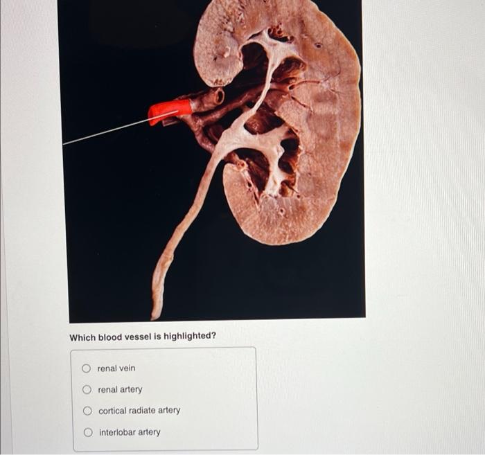 Solved Which blood vessel is highlighted? renal vein renal | Chegg.com