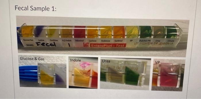 Fecal Sample 1: Fecal Sample 2 Fecal Samnle ? | Chegg.com
