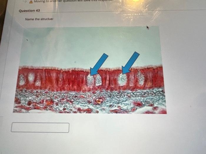 Solved Name the structue: | Chegg.com