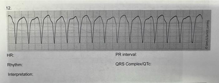 Solved 13. Interpretation:14. Interpretation: Paced atrial | Chegg.com