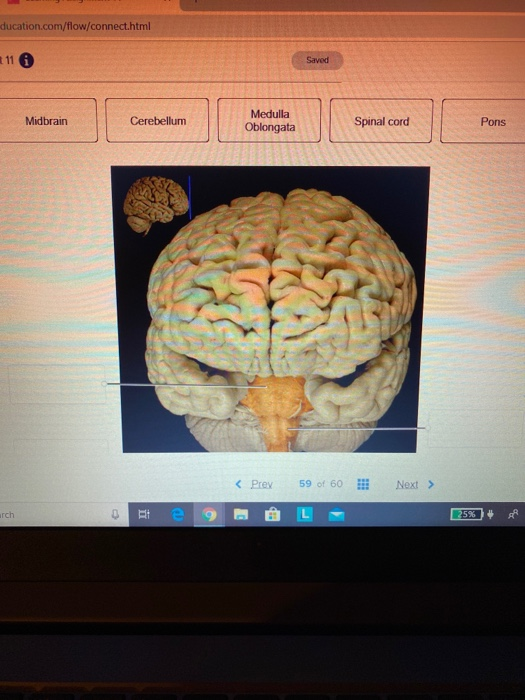 Solved ducation.com/flow/connect.html 11 Saved Midbrain | Chegg.com