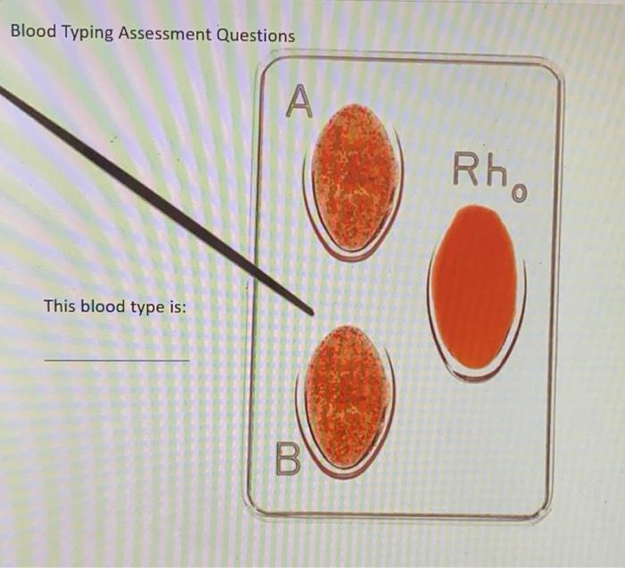 Solved Blood Typing Assessment Questions A Rho This blood | Chegg.com