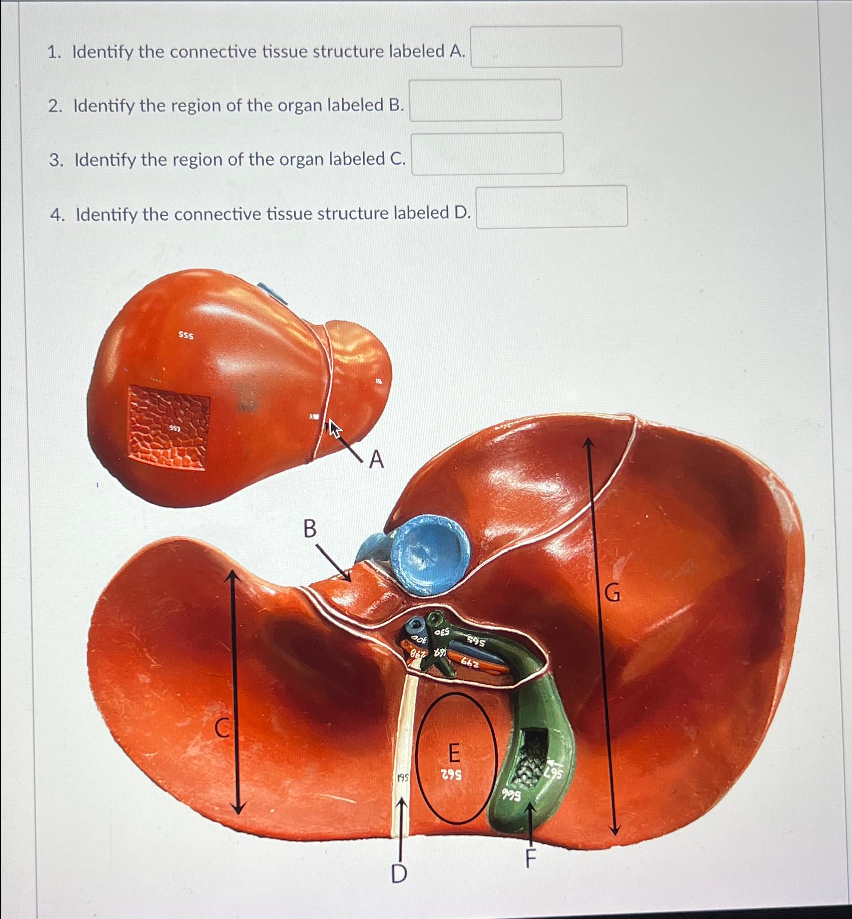 Solved Identify the connective tissue structure labeled | Chegg.com Solved Identify the connective tissue structure labeled | Chegg.com