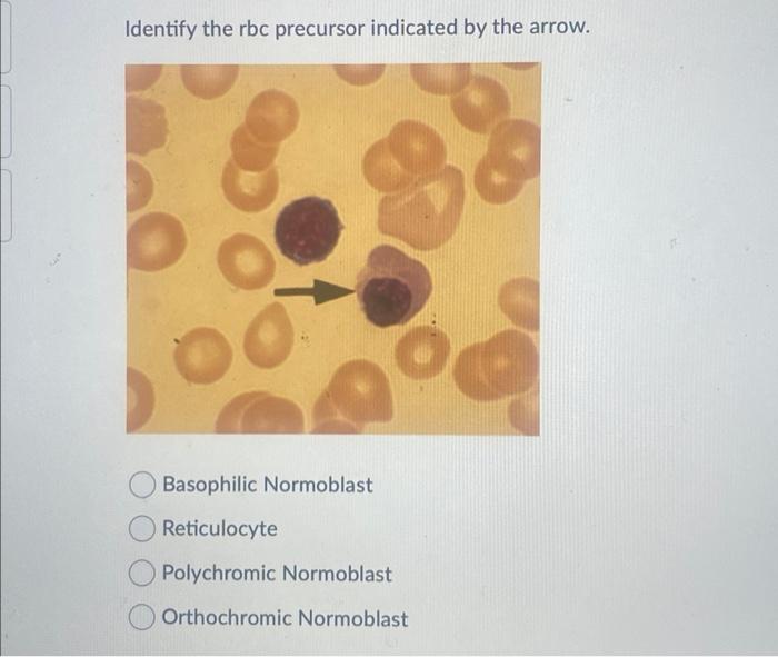 Solved Which of the following is derived from the common | Chegg.com