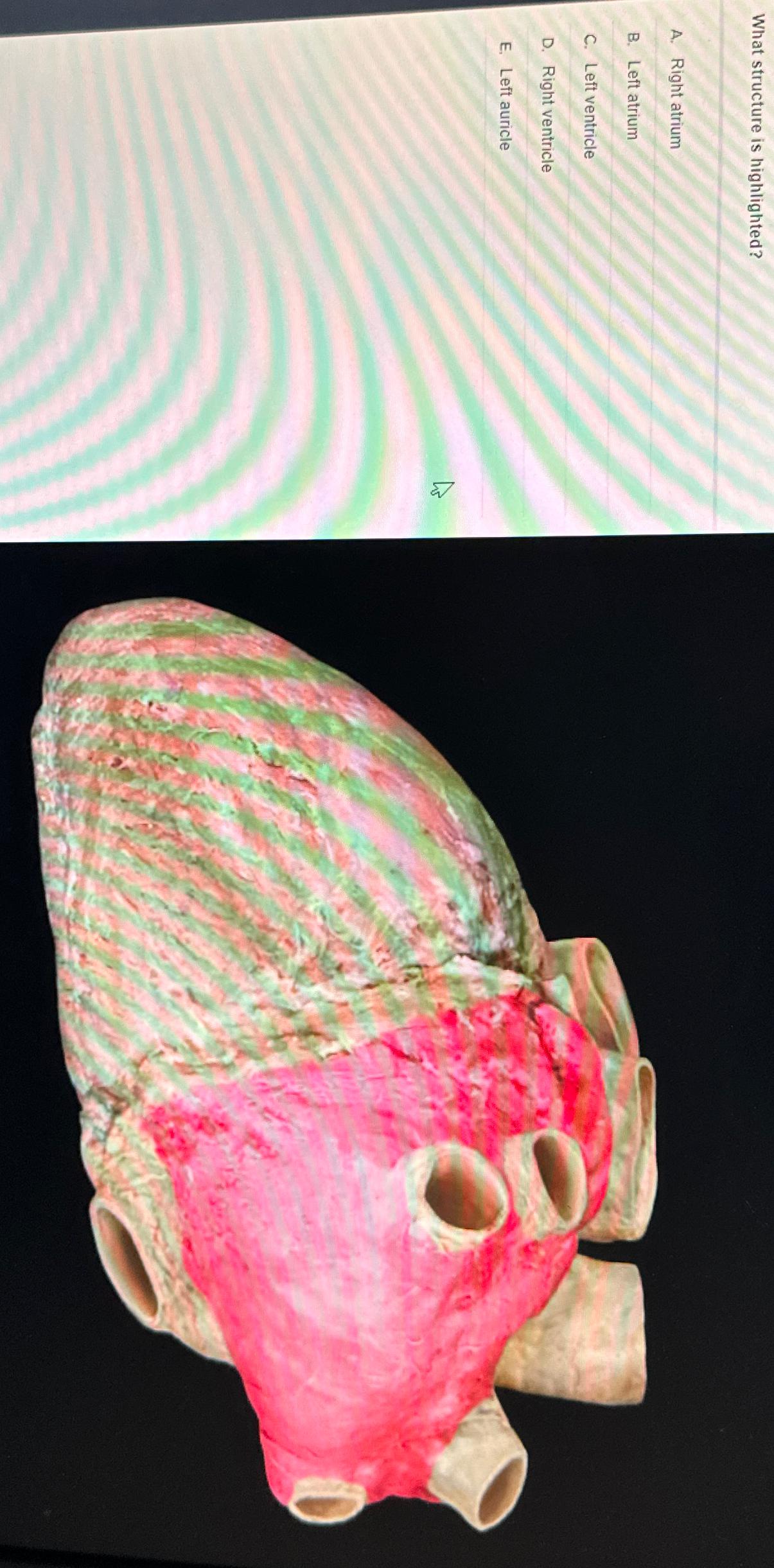 Solved What ateucture is highlighted? A. ﻿right atriumB. | Chegg.com