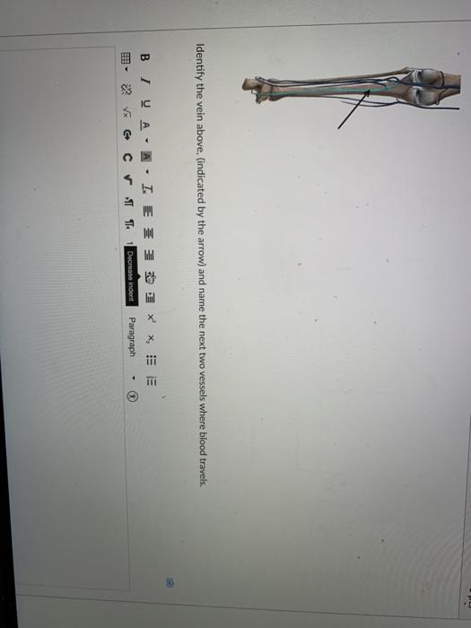 Solved Identify the vein above, (indicated by the arrow) and | Chegg.com