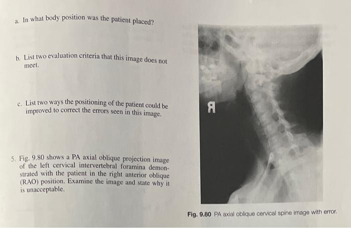 Solved a. In what body position was the patient placed? b. | Chegg.com