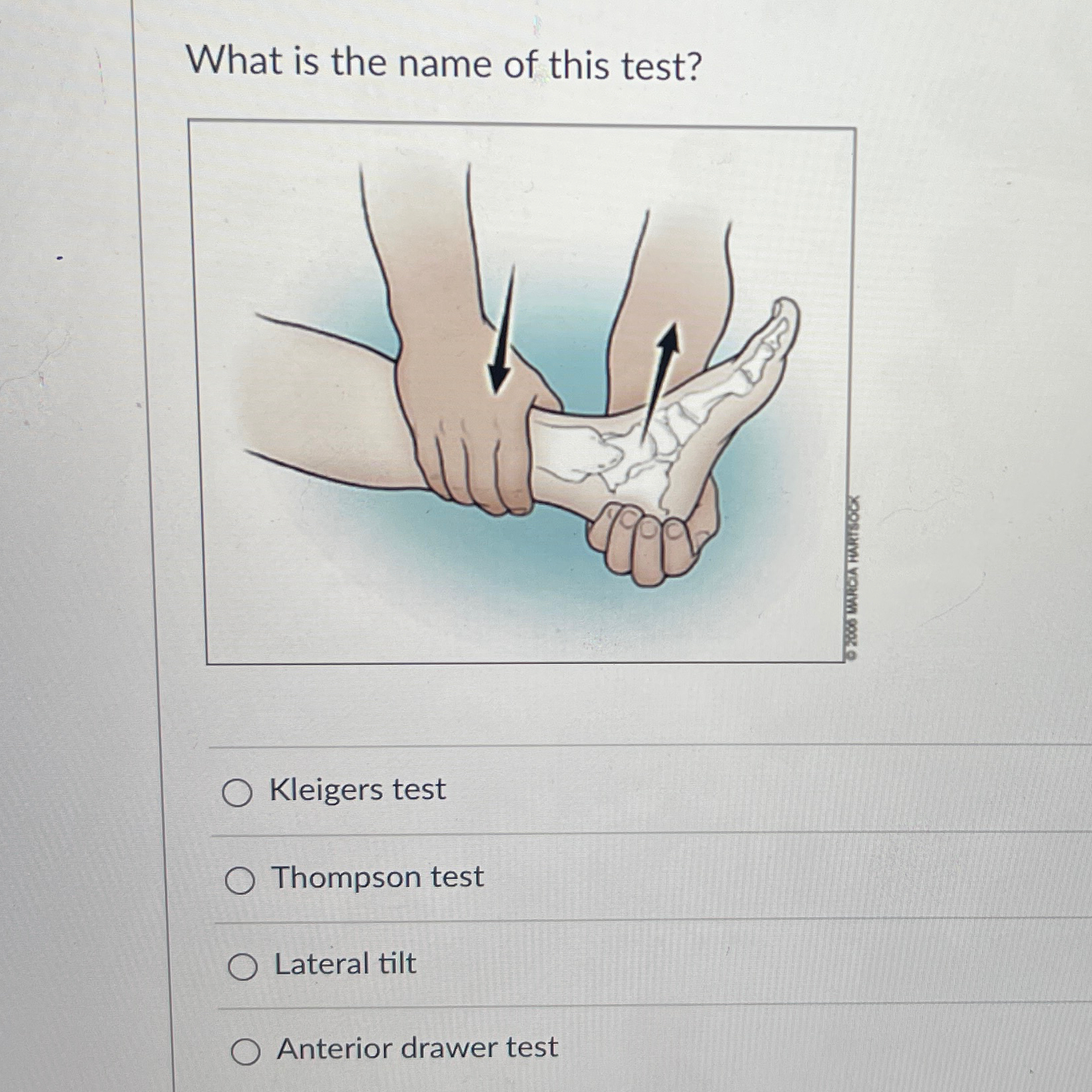 Solved What is the name of this test?Kleigers testThompson | Chegg.com