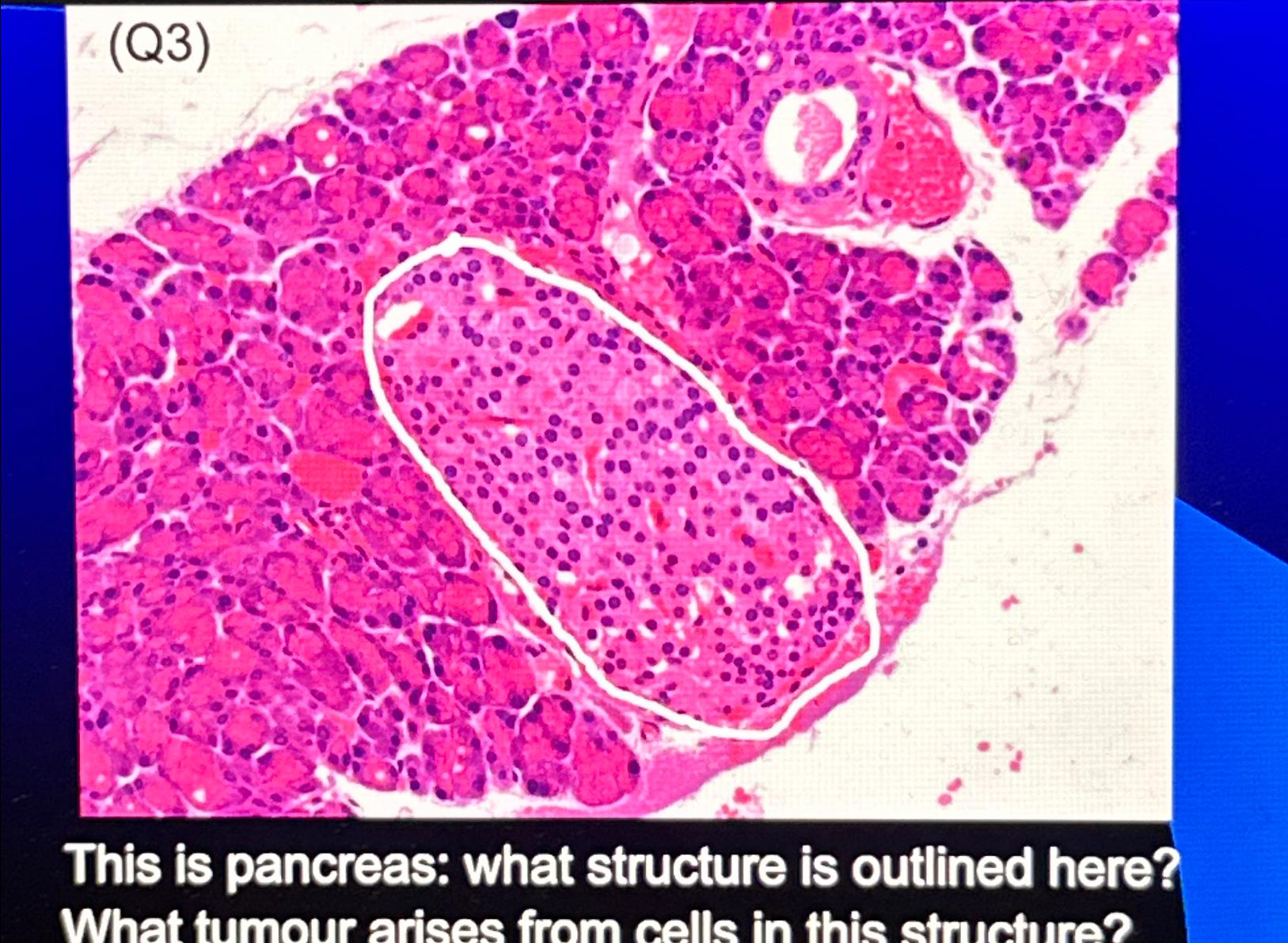 Solved This is pancreas: what structure is outlined here? | Chegg.com