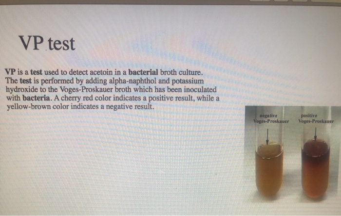 Solved Differentiation test Sucrose Fermentation Test • | Chegg.com