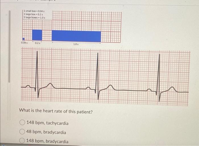Solved What is the heart rate of this patient? 148 bpm, | Chegg.com