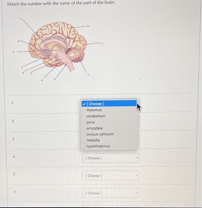 Solved Match the number with the name of the part of the | Chegg.com