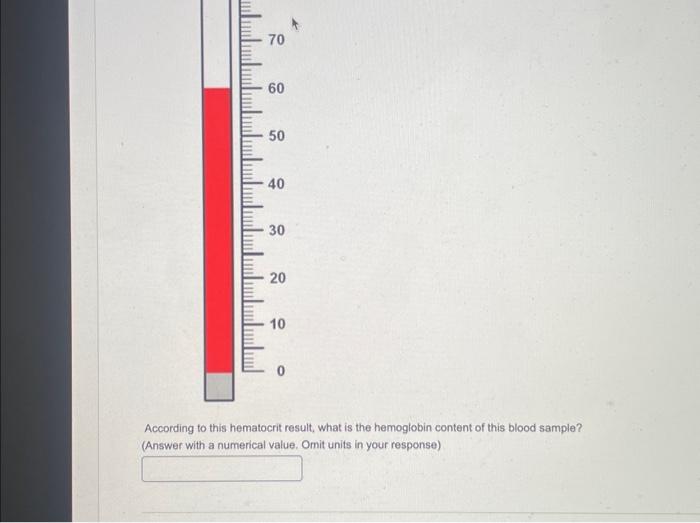 Solved According to this hematocrit result, what is the | Chegg.com