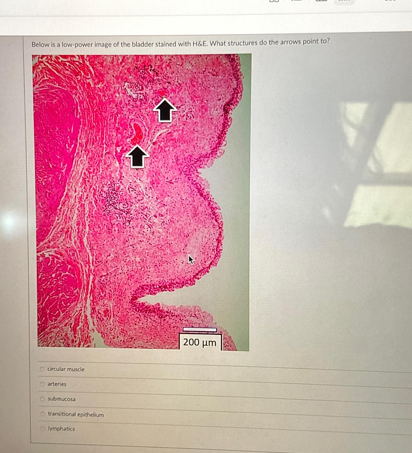 Solved Below is a low-power image of the bladder stained | Chegg.com