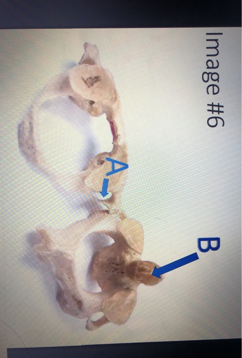 Solved Use the images to identify the bones and the bony | Chegg.com