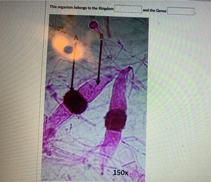 Solved An acid fast bacterium stains a Select color and a | Chegg.com