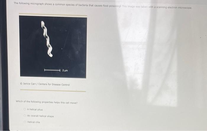 Solved The following micrograph shows a common species of | Chegg.com