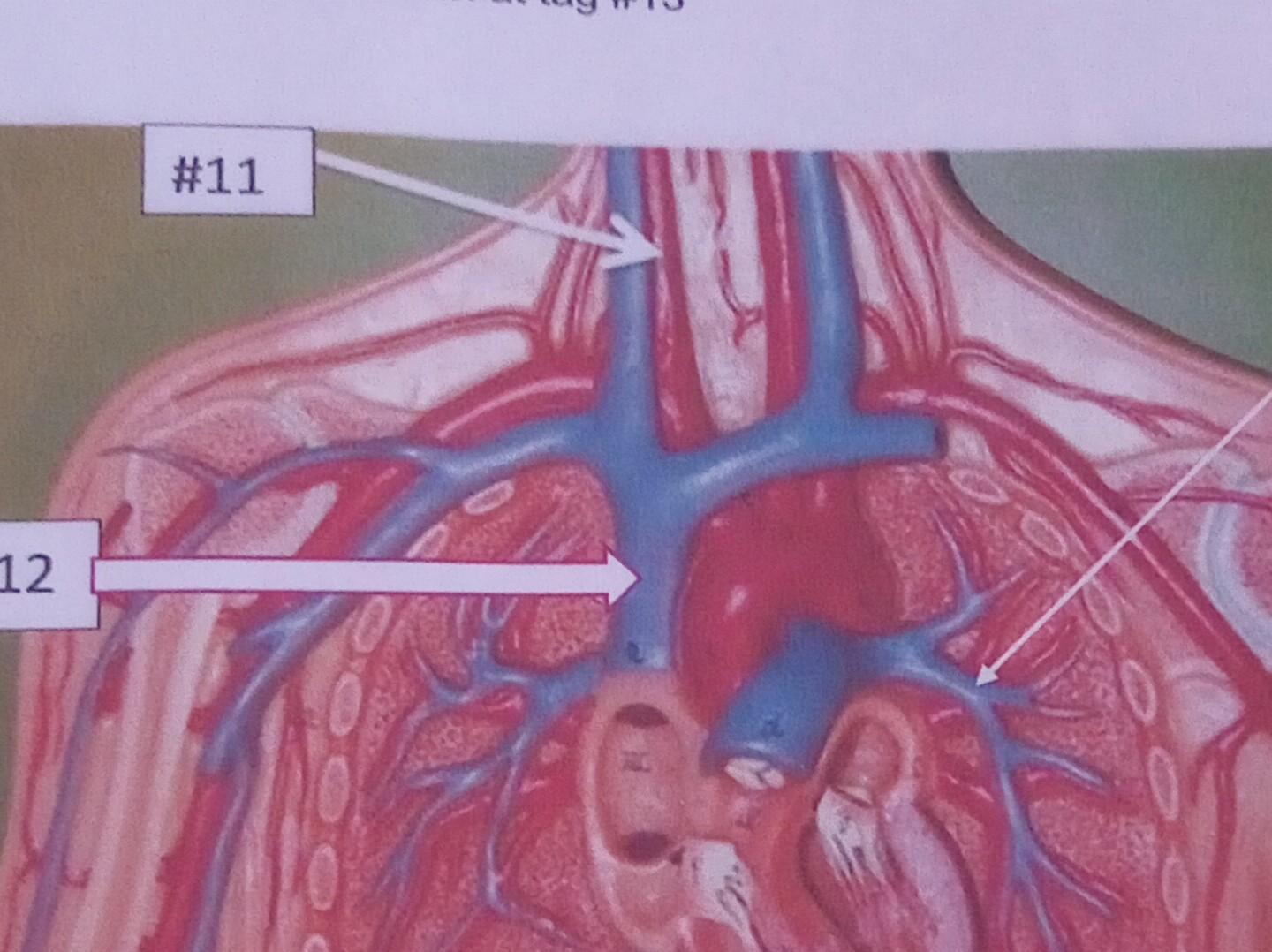 Solved Identify The Three Vessels In The Picture Chegg