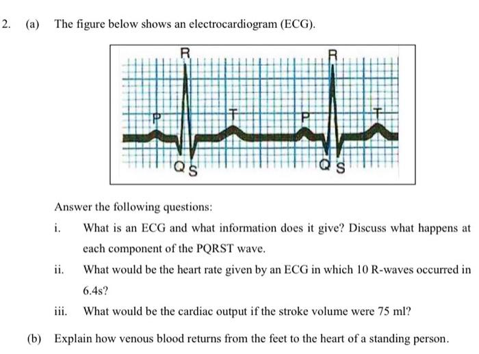 Solved (a) The figure below shows an electrocardiogram | Chegg.com