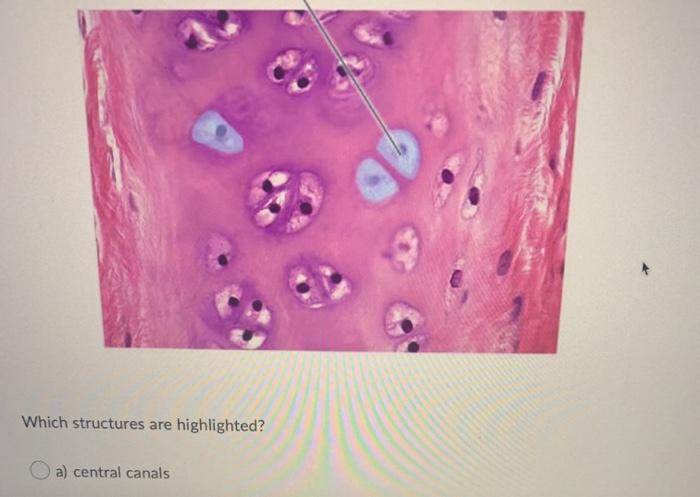 Solved Which structure is highlighted? a) chondrocyte b) | Chegg.com