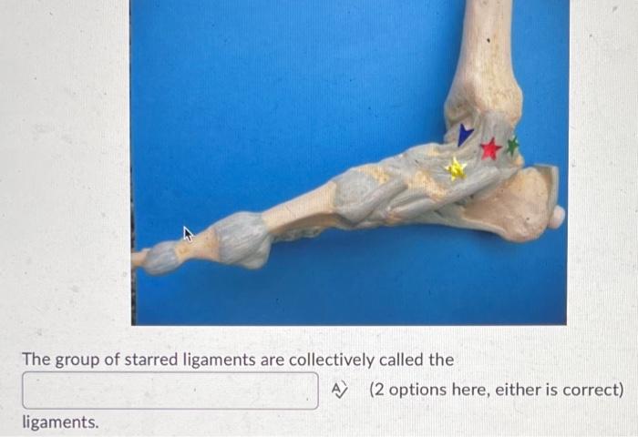 Solved Identify the bony landmark A (2 words). The group of | Chegg.com