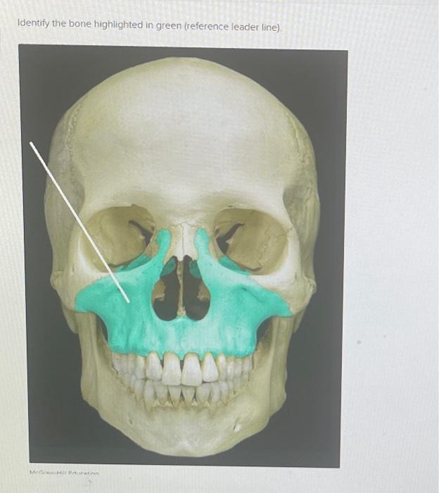 Solved 24 Identify the bone highlighted in green (reference | Chegg.com