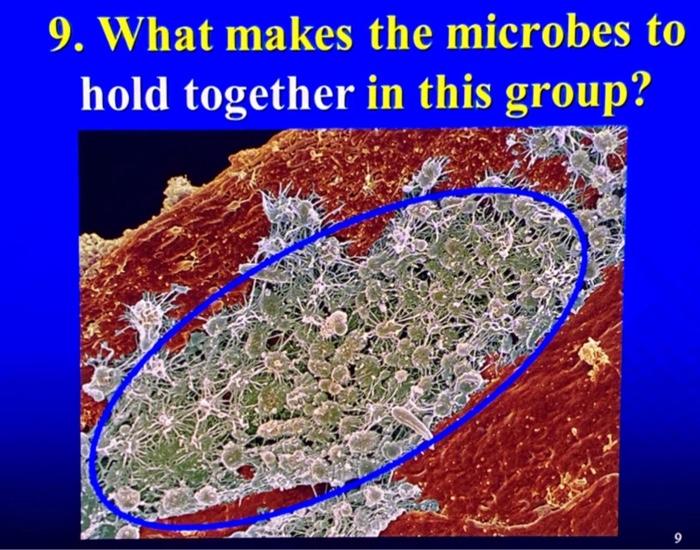 Solved 9. What makes the microbes to hold together in this | Chegg.com