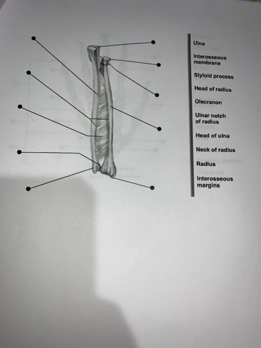 Solved Ulna Interosseous membrane Stylold process Head of | Chegg.com