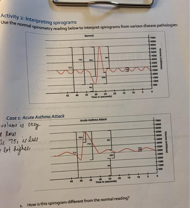 Solved Activity 2: Interpreting spirograms Use the normal | Chegg.com