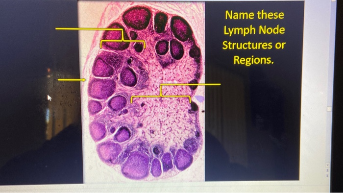 Solved Name these Lymph Node Structures or Regions. Name | Chegg.com