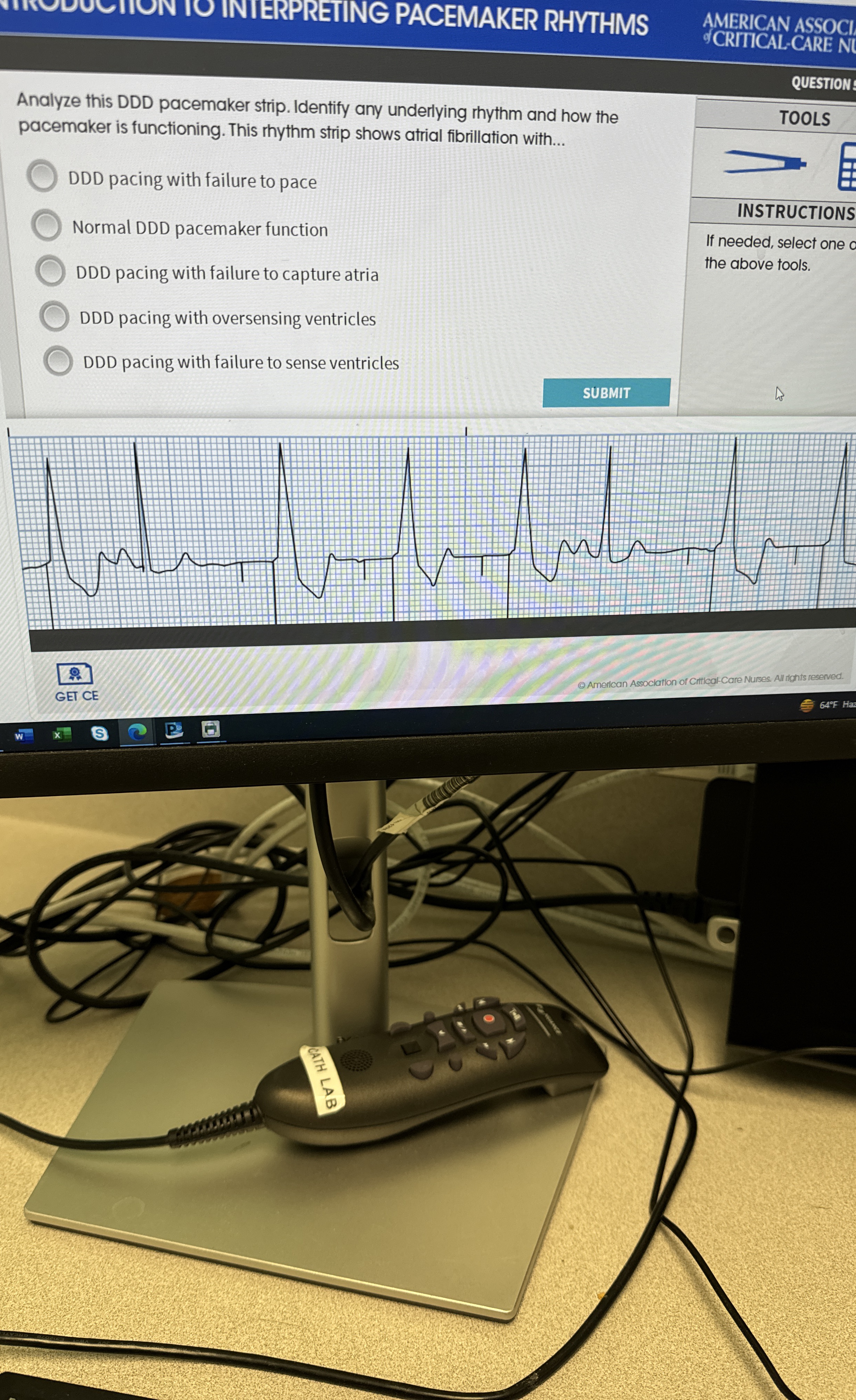 Solved Analyze this DDD pacemaker strip. Identify any | Chegg.com