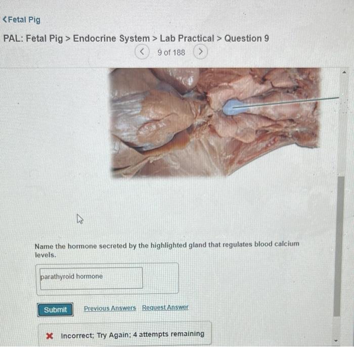 Solved Endocrine System > Lab Practical > Question 9