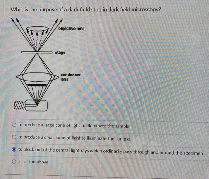 Solved What is the purpose of a dark field stop in dark | Chegg.com