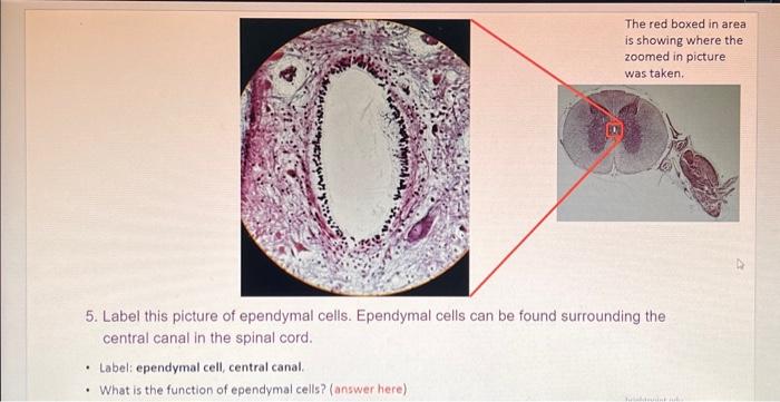 Solved 5. Label this picture of ependymal cells. Ependymal | Chegg.com