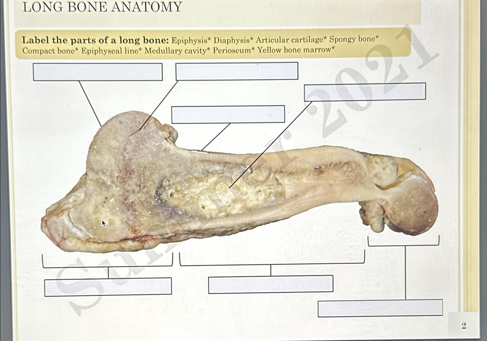 Solved LONG BONE ANATOMYLabel the parts of a long bone: | Chegg.com