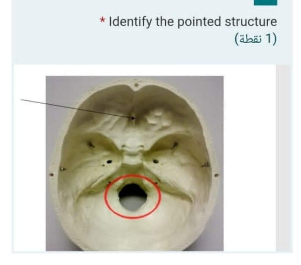 Solved Identify the pointed structure (1) (1 نقطة) | Chegg.com