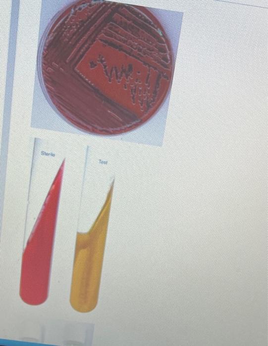 Solved the following media and biochemical results, identify | Chegg.com