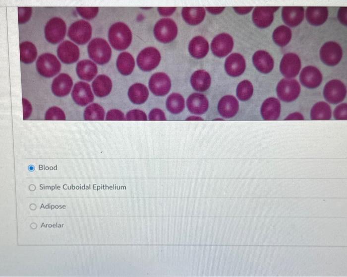 Solved Identify this tissue: Blood Simple Cuboidal | Chegg.com