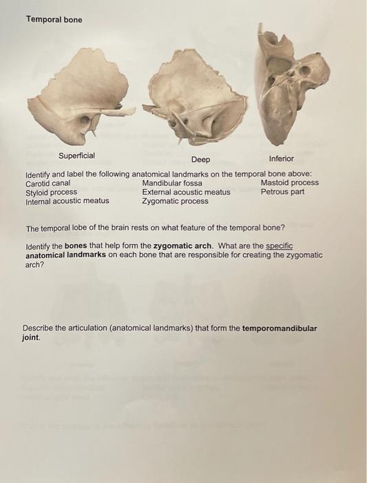 Solved Temporal bone Superficial Deep Inferior Identify and | Chegg.com