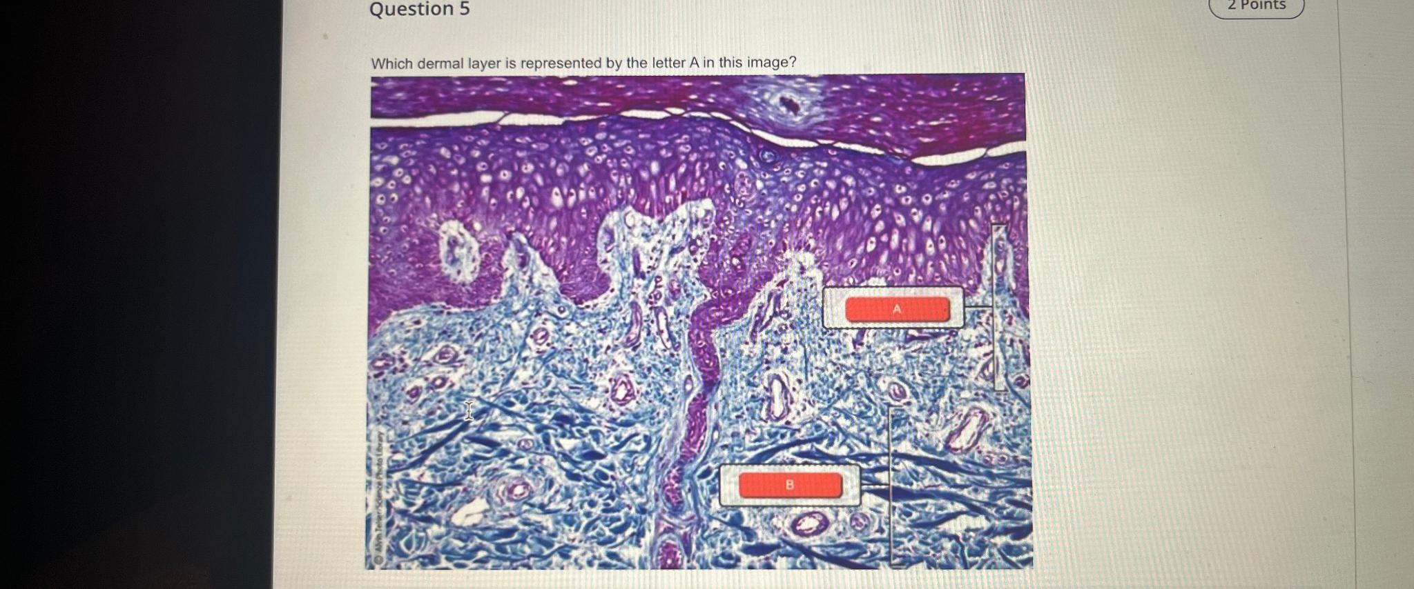 Solved Question 52 PointsWhich dermal layer is represented | Chegg.com Solved Question 52 PointsWhich dermal layer is represented | Chegg.com